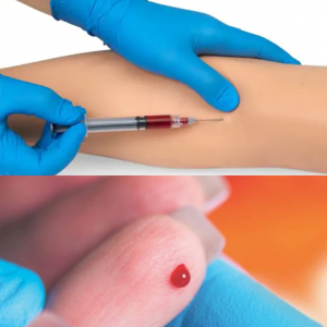 Understanding Arterial vs. Capillary Puncture: A Guide for Aspiring ...